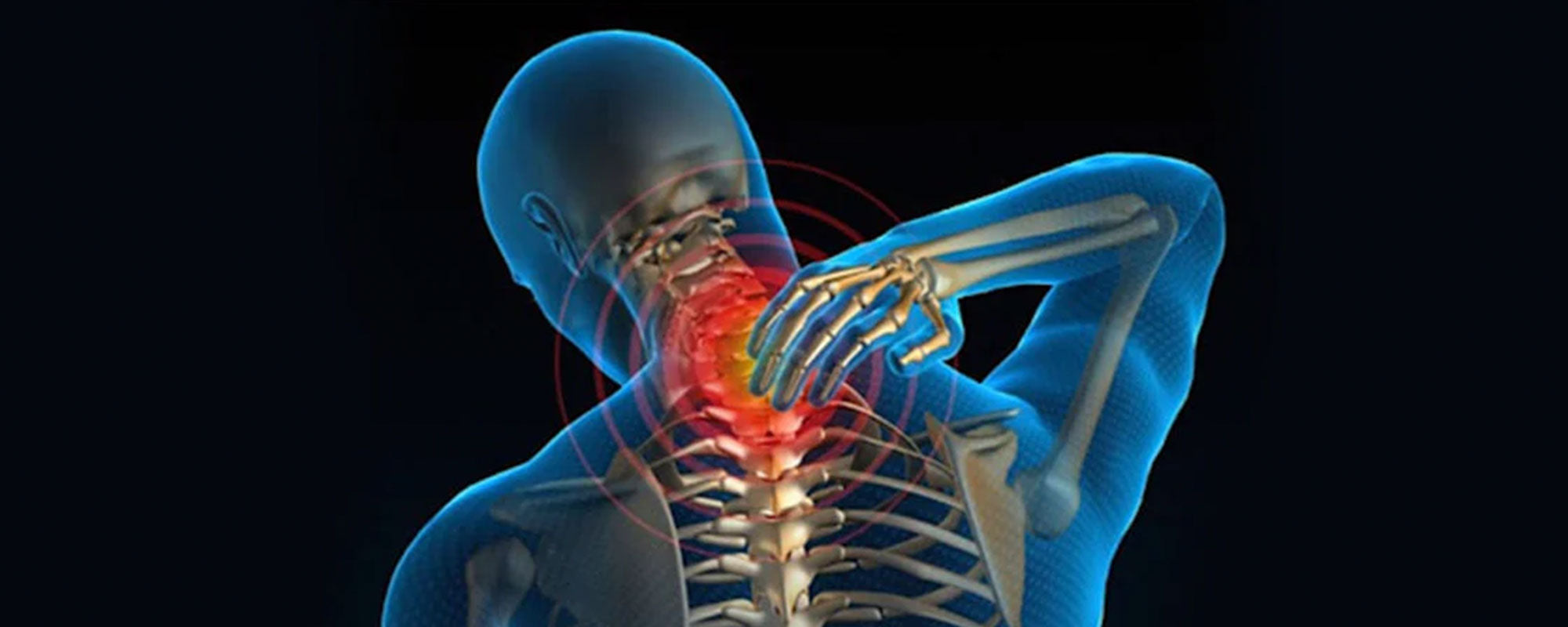 A Complete Guide About Sore Neck in Jiu Jitsu. Prevention, Causes ...