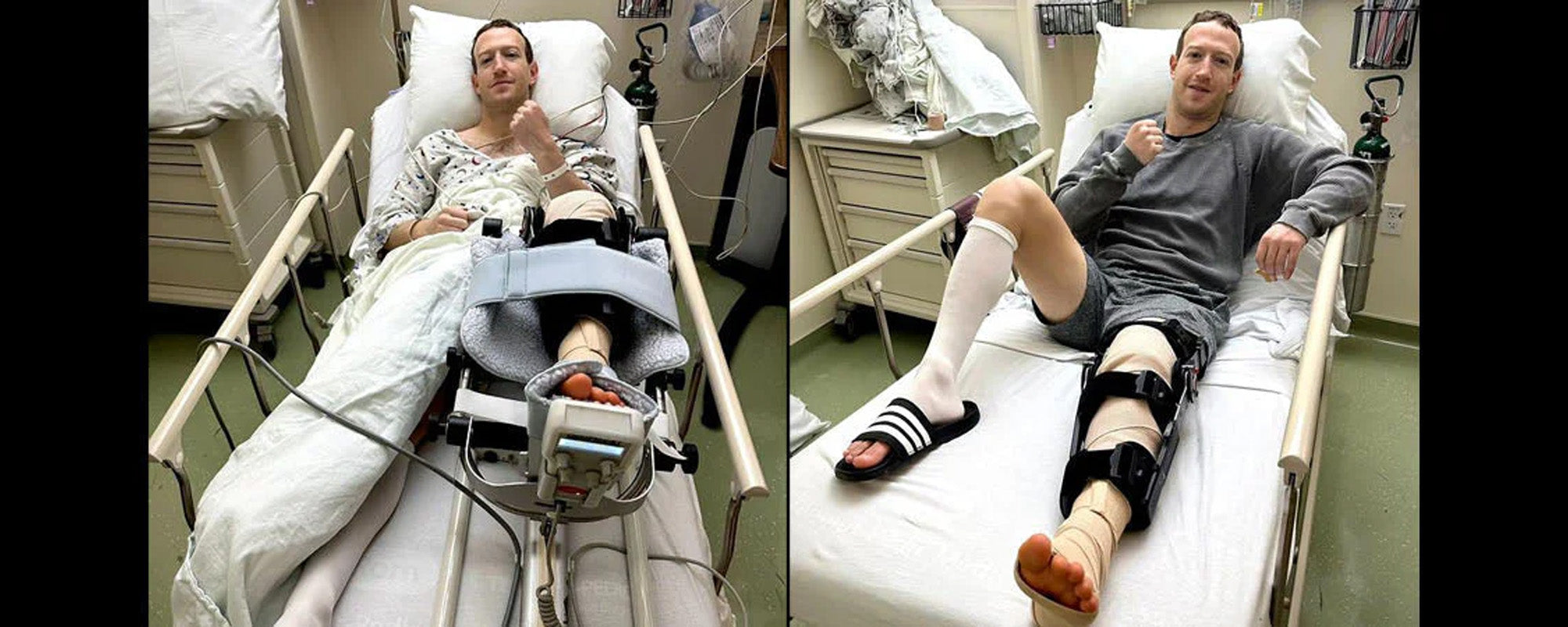 Mark Zuckerberg Undergoes ACL Surgery After Injury In Training For MMA ...